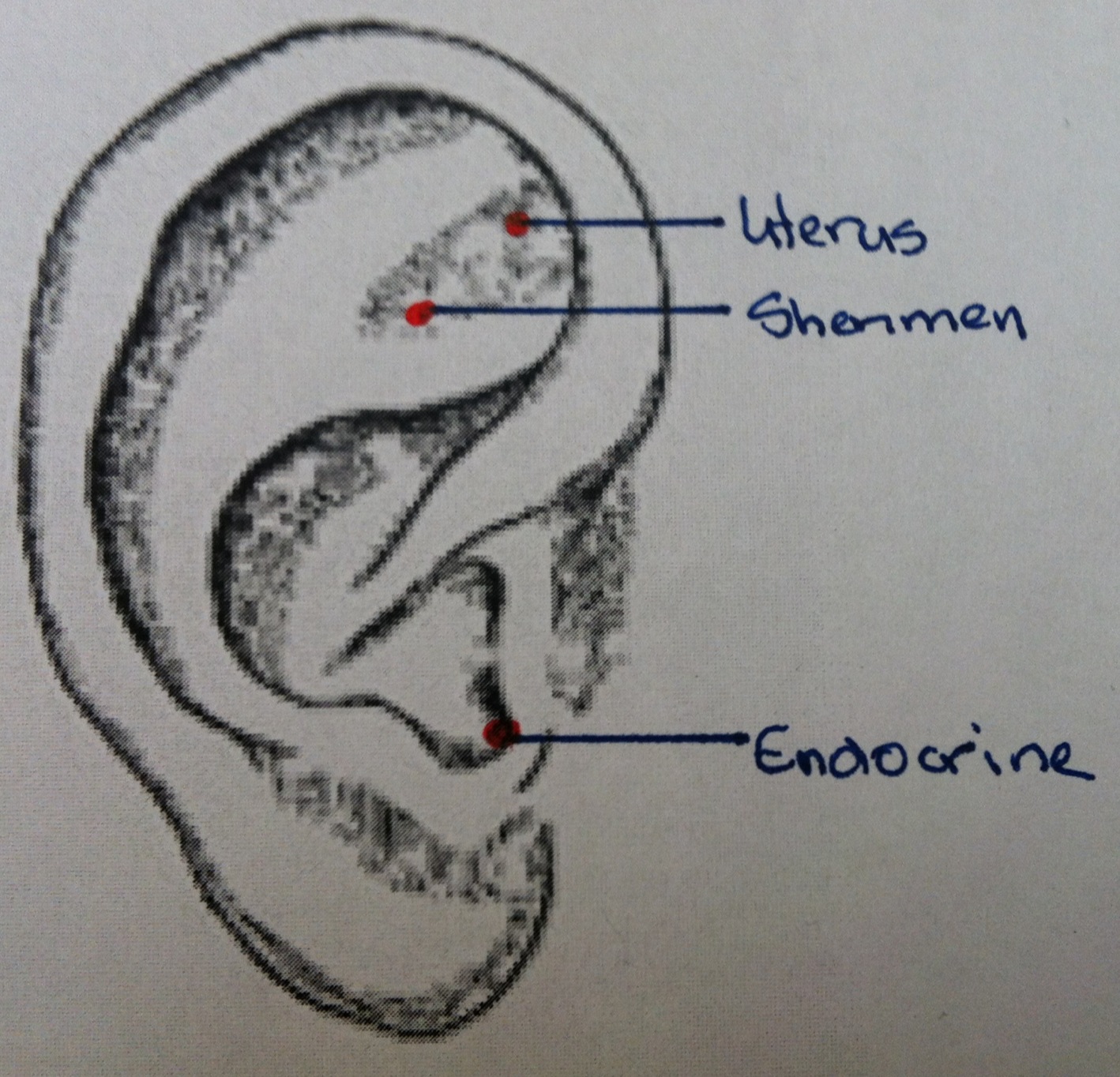 labour-ear-acu - Radiance Chinese Medicine and Wellness Centre