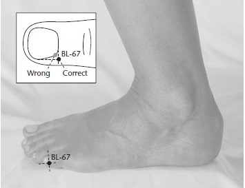 Blog -6-UB-67 - Radiance Chinese Medicine and Wellness Centre